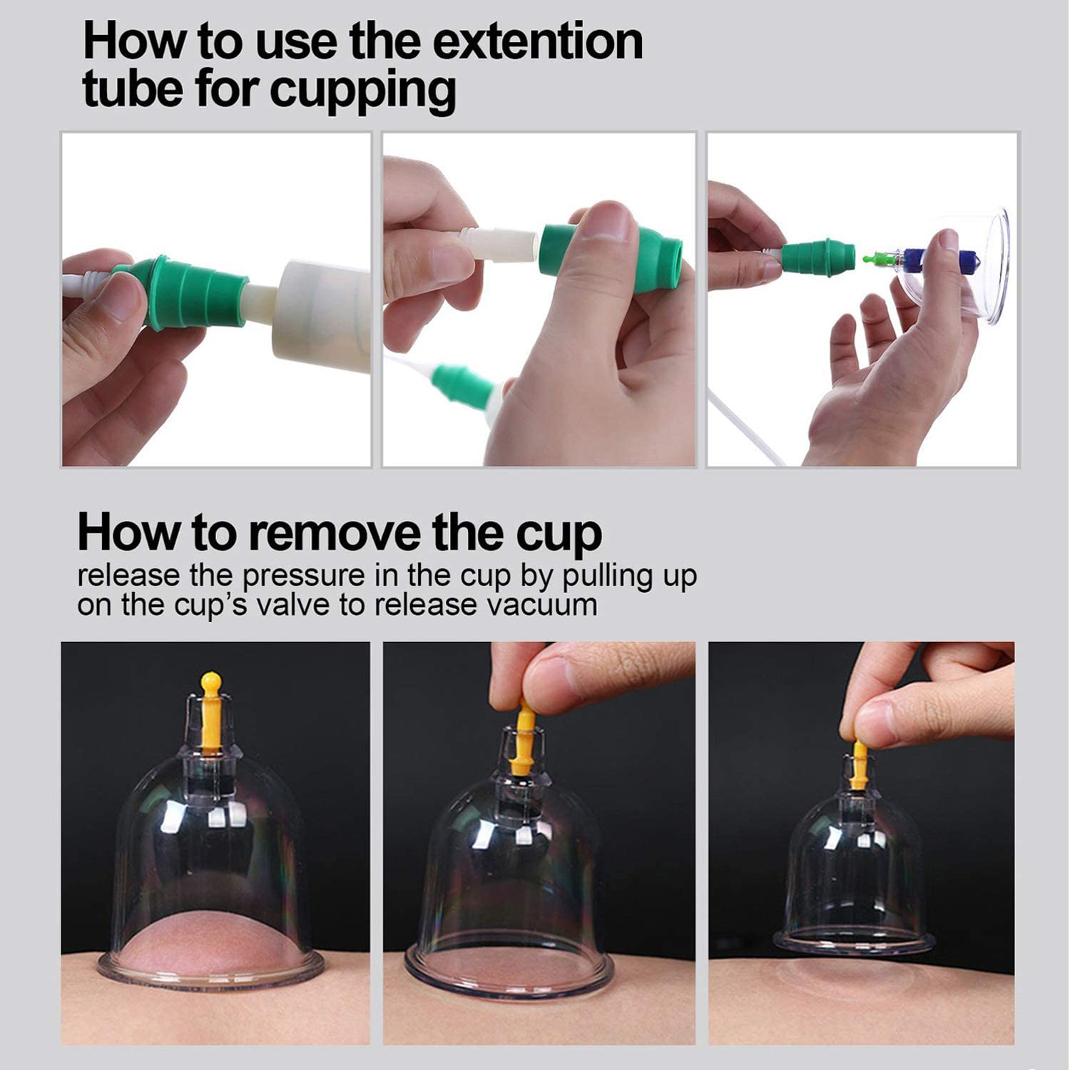 Negative pressure cupping device 1*12 cans – NewYork Beauty Equipment ...